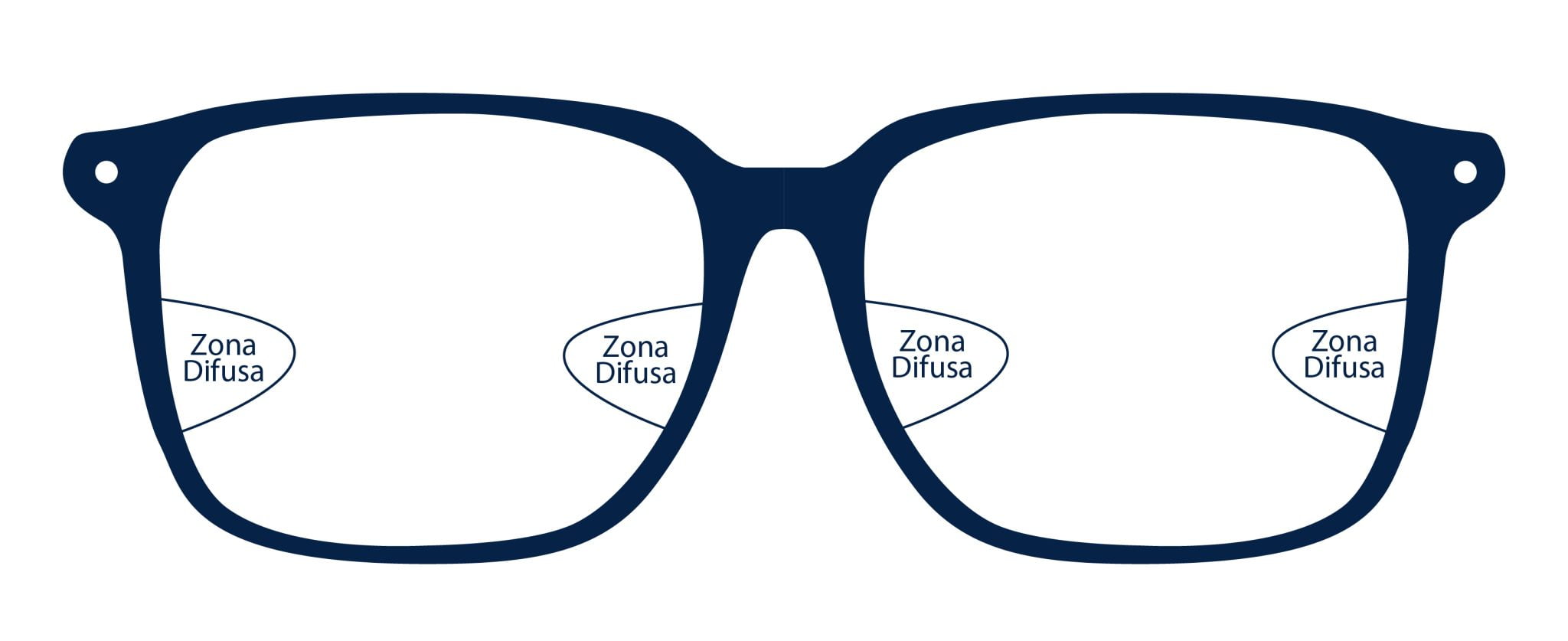 Lentes multifocales - Montevideo